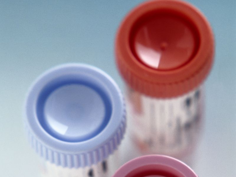 Prices of generic heart failure drugs vary widely - UPI.com