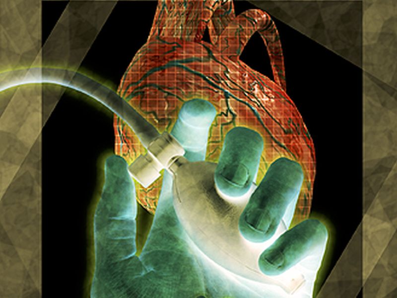 Hackers could target heart devices, review suggests - UPI.com