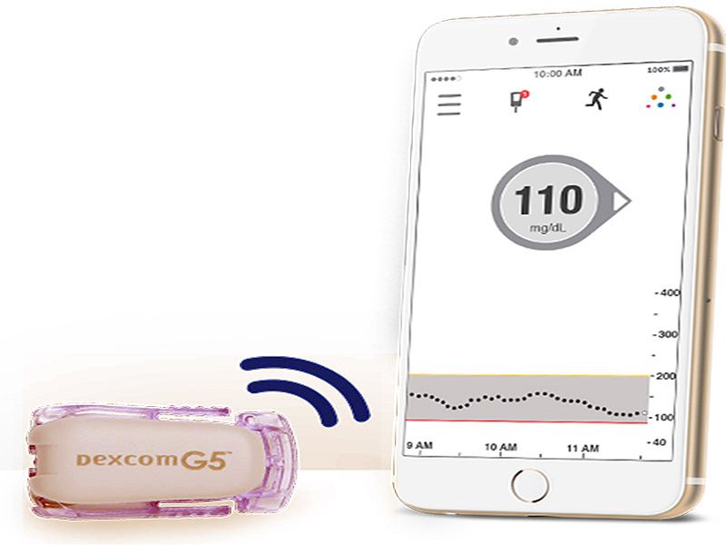 FDA OKs diabetes device that may replace fingerstick tests - UPI.com